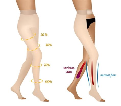 Why Winter Is The Best Time For Varicose Vein Treatment