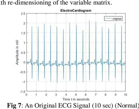 figure 7 from classification of arrhythmia from ecg signals using