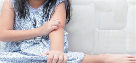 Largest Paediatric Trial Investigates Treatments For Severe Atopic