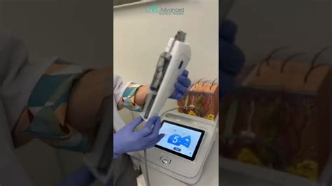 Medtech Needle Free Mesotherapy Device Youtube