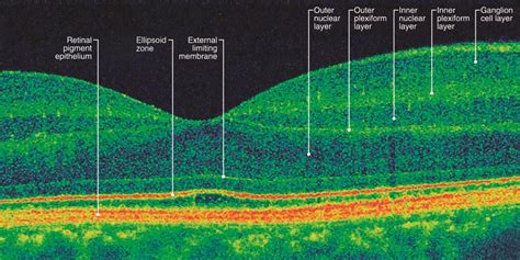 Oct Ferst Eye Institute