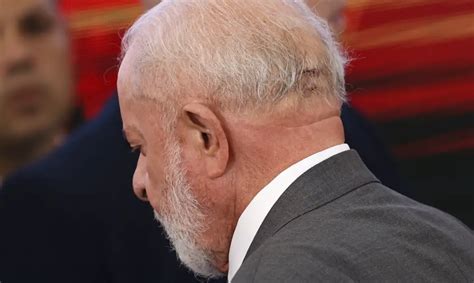 Lula está lúcido orientado e conversando diz boletim médico ICL