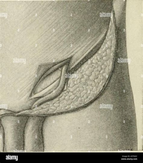 Pubic Triangle Hi Res Stock Photography And Images Alamy