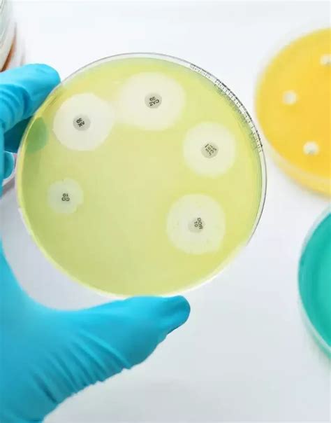 What Is Mra Screening Ems Ambulance