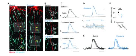 Loss Of Saltatory Propagation And Narrowing Of Nodal Action Download Scientific Diagram