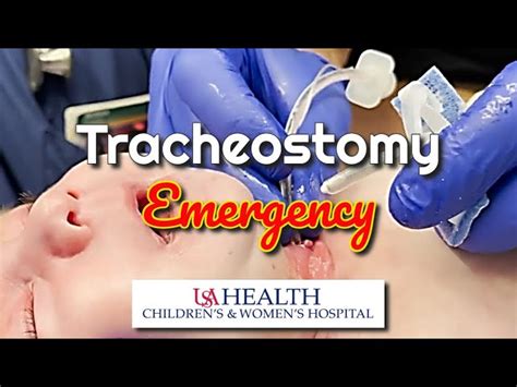 Emergency Tracheostomy Procedure