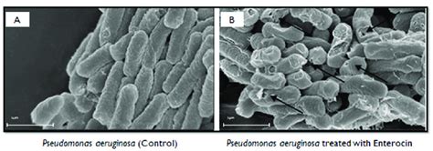 Mode Of Action Of Enterocin Kae 01 Using Sem P Aeruginosa A Control Download Scientific