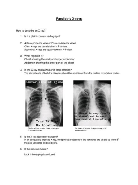 Notes Of Paediatrics X Rays Pdf Thorax Lung