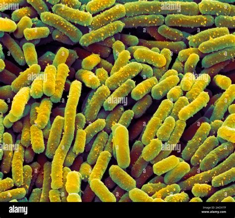 Lactobacillus Bacteria Coloured Scanning Electron Micrograph Sem Of Lactobacillus Delbrueckii