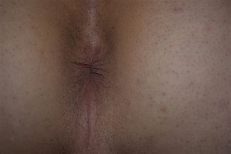 Jungen Muschi Arschloch Weit Offen 18 Pics Xhamster