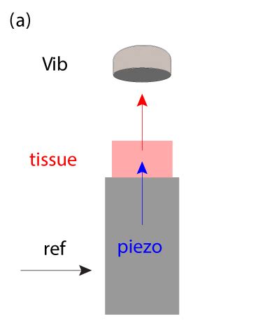 Laser Vibration Measurement Enhances Osteoarthritis Therapy Polytec Magazine