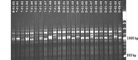 Banding Pattern Of Different Jatropha Curcas Accessions Using Primer