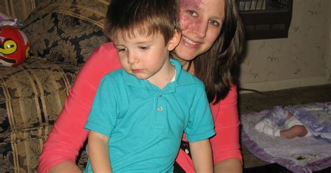 Our Pku Life Pku Awareness