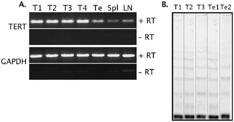 Tert Expression And Telomerase Activity In Dftd And Tasmanian Devil