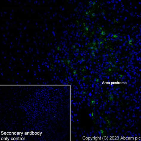 Anti Gfral Antibody Epr28368 150 Ab315899 Abcam