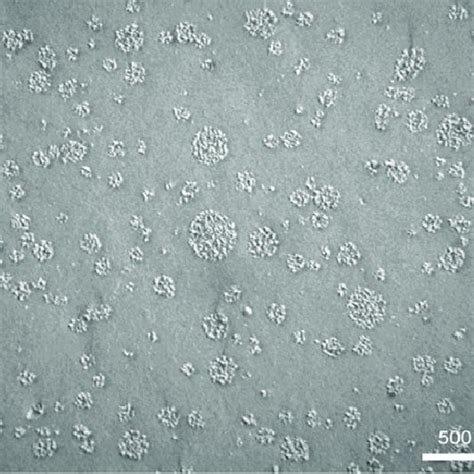 Freeze Fracture Transmission Electron Micrograph Of Casein Micelles