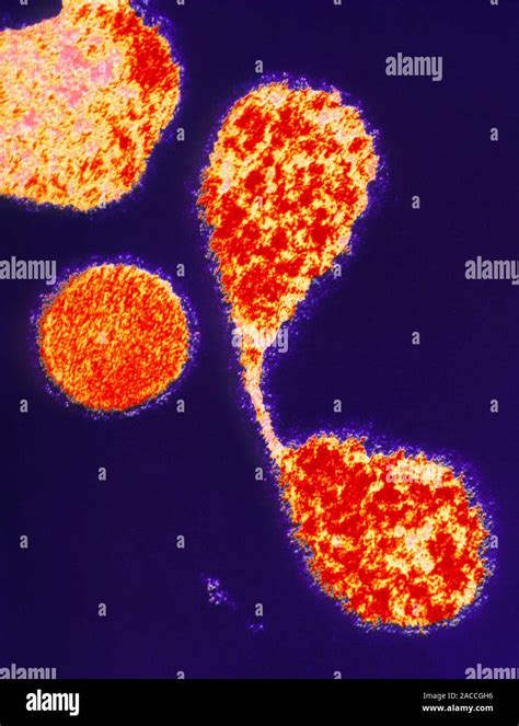 Mycoplasma Pneumoniae Coloured Transmission Electron Micrograph Tem Of A Section Through
