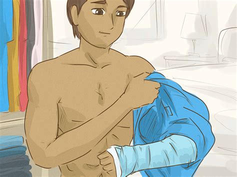 3 Ways To Have Fun With A Broken Arm WikiHow