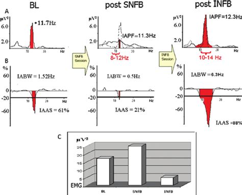 a plots — the eeg band power values for the averaged parietal
