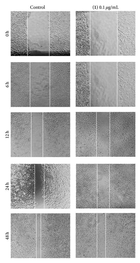 Effect Of Moscatilin 1 On H460 Cell Migration A Confluent