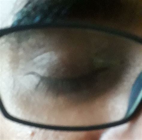 Drowsinessdetection Object Detection Dataset By Supcom