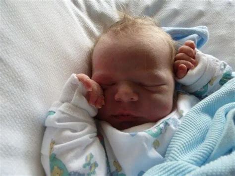 Cervidil Induction Whats It Like