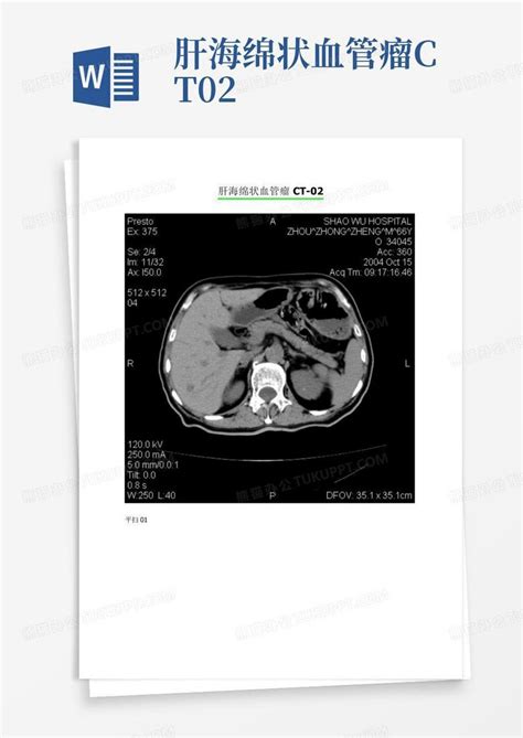 肝海绵状血管瘤ct 02Word模板下载 编号qrznmxwz 熊猫办公