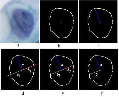 A Part Of The Initial Image B Nucleus Boundaries C Nucleus