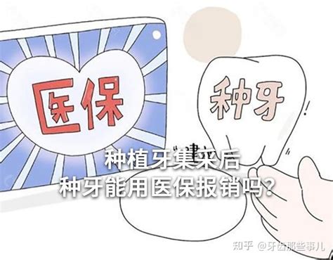 种植牙能用医保报销吗 知乎
