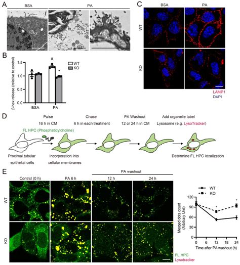 Pa Induced Tfeb Activation Promotes Lysosomal Exocytosis Of