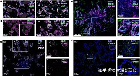 【nature Protocols】系列：定向分化多能干细胞生成远端肺类器官 知乎