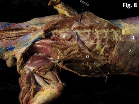 Deep Thoracic Ventral Muscles Diagram Quizlet