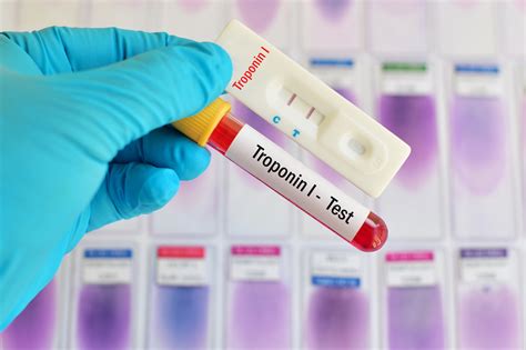 Reassessing The Upper Limit Of Normal In High Sensitivity Cardiac