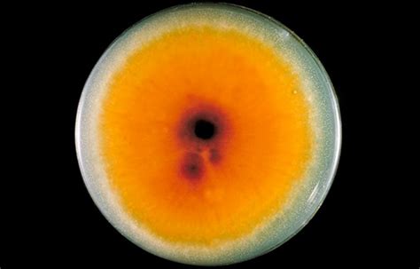 New Sexually Transmitted Infection Trichophyton Mentagrophytes Type Vii Found In Us