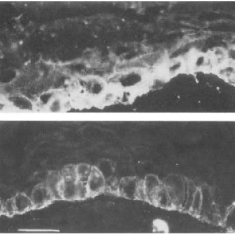 Localization Of Integrins In Keratinocyte Colonies By Indirect