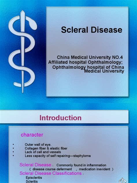 Sclera Diseases Vision Medical Statistics
