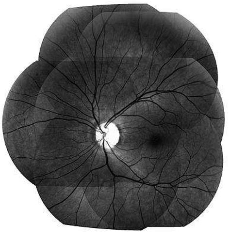 1 An Example Mosaic Download Scientific Diagram