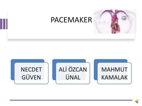 Cm Pacemaker Pppptx
