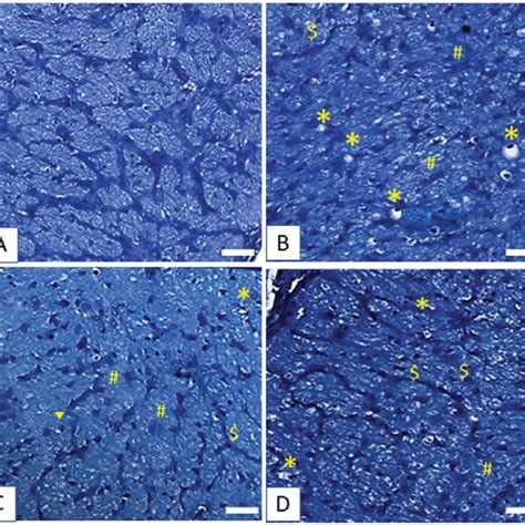 Representative Microphotographs Of Rat Retinal Sections Stained With