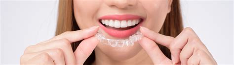 How Does Invisalign Work Common Myths About Invisalign