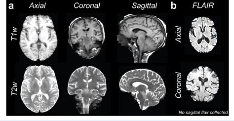 A Labeled Clinical MRI Dataset Of Nigerian Brains