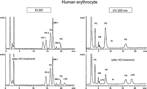 Ethanolamine Plasmalogens Semantic Scholar