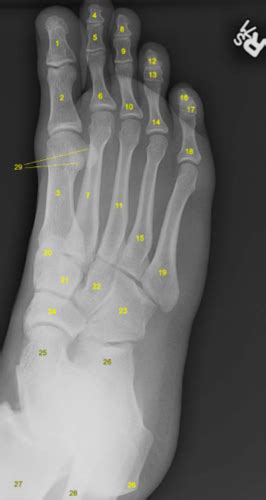 Chapter Lower Limb Visuals Flashcards Quizlet
