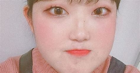 故최진실 딸 최준희가 앓는 루푸스병은 온몸에 염증