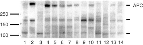 Adenomatous Polyposis Coli Protein Expression In Ovarian Tissue Samples