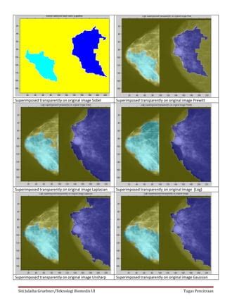 Modifikasi Matlab Program Untuk Pemrosesan Citra Medis Pdf