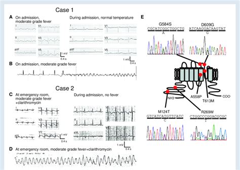 Electrocardiograms Ecgs And Location Of Kcnh2 Variants In Patients