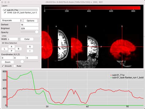 Mricrogl Tutorial 3 Viewing Images — Andys Brain Book 1 0 Documentation