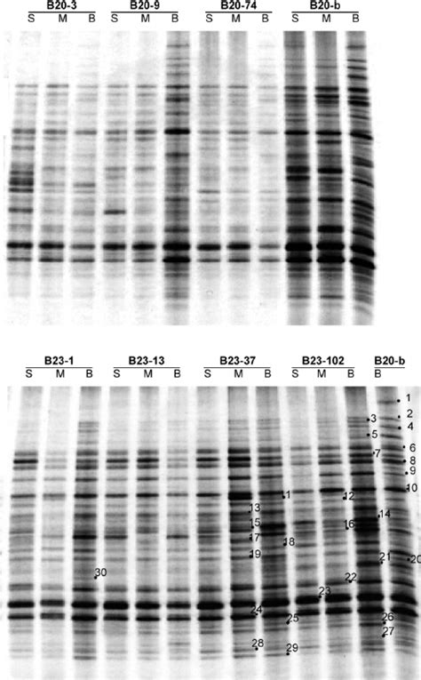 Denaturing Gradient Gel Electrophoresis Profiles Showing Bacterial