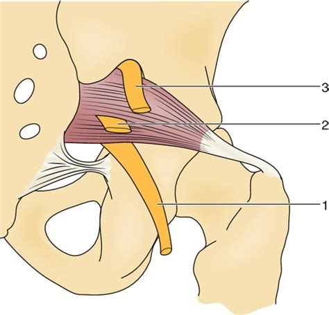 Icd Code For Piriformis Syndrome Quotes Resume